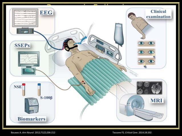 Update on Targeted Temperature Management | PPT