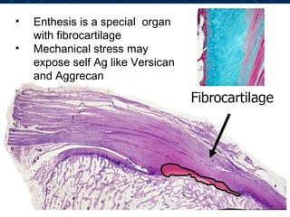 Update pathogenesis of spondyloarthritis | PPT