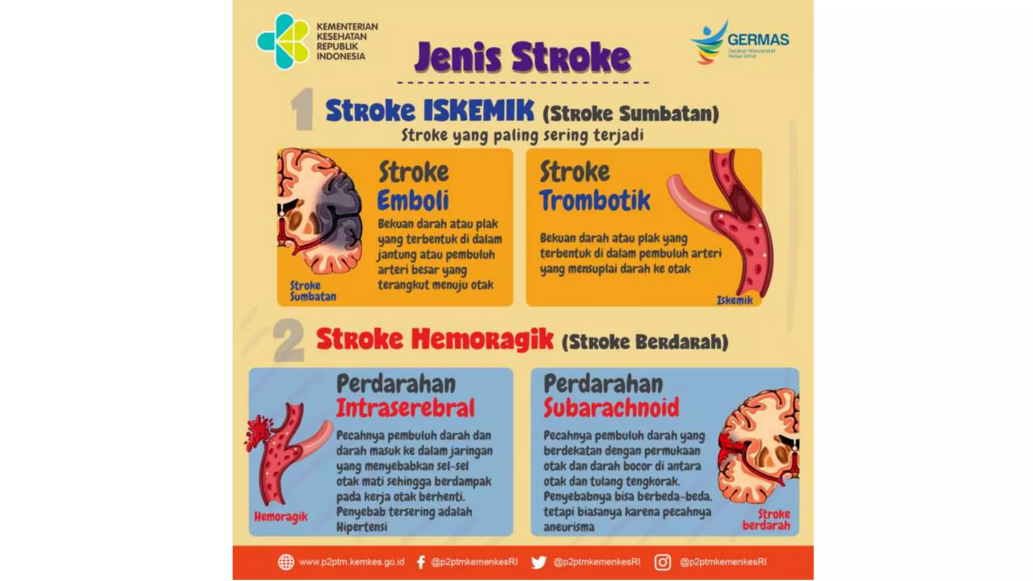 Update & Refreshment stroke.pptx