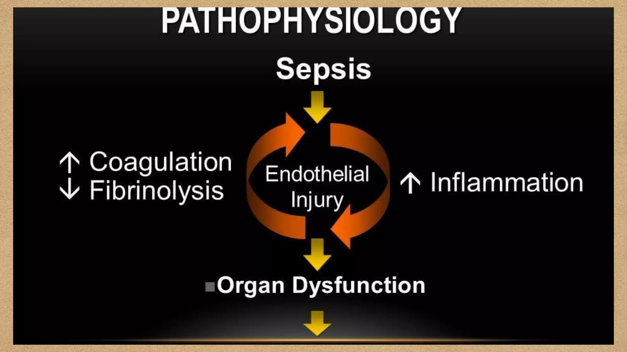 Updates on sepsis & septic shock | PPT