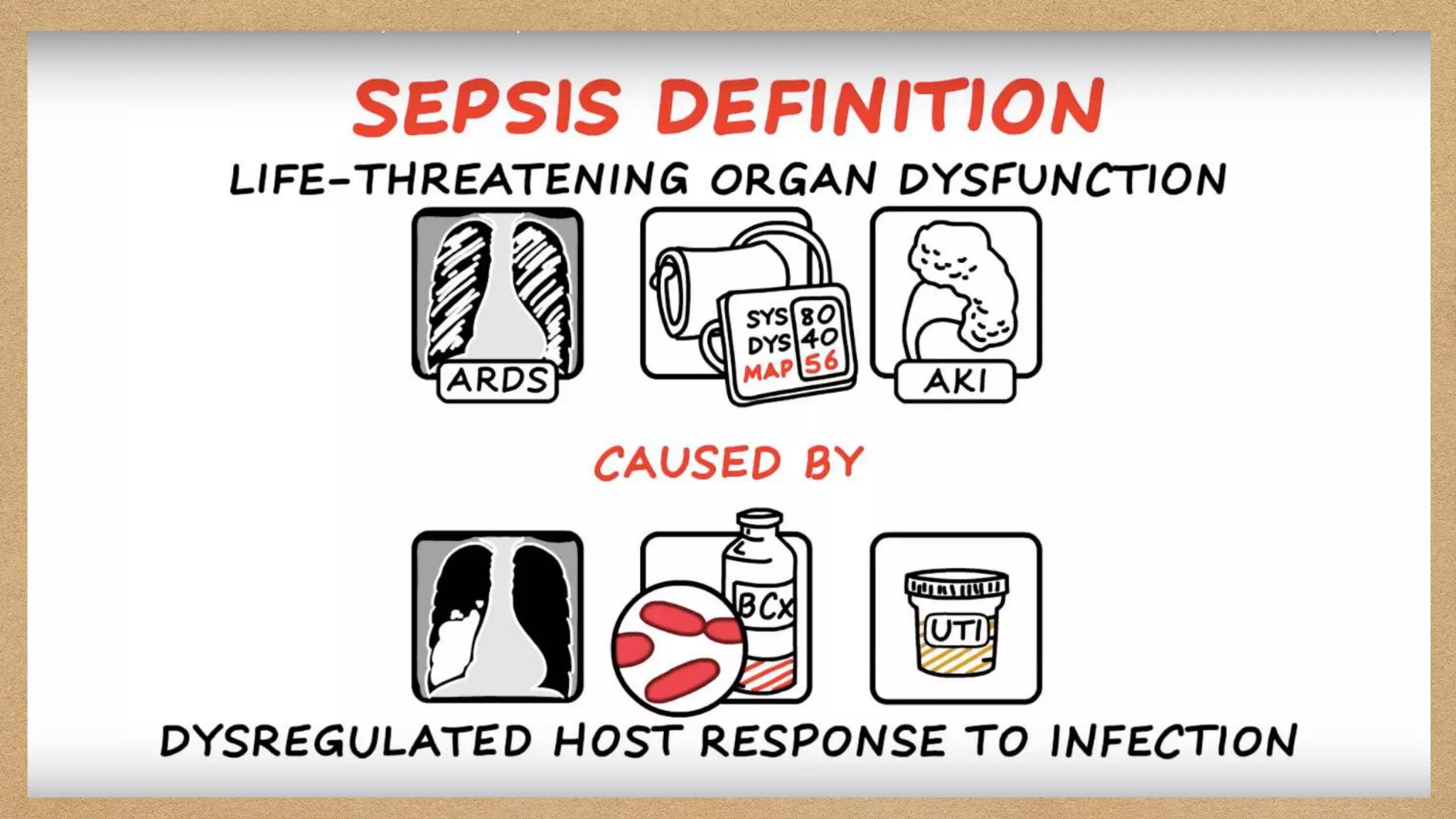 Updates on sepsis & septic shock | PPT