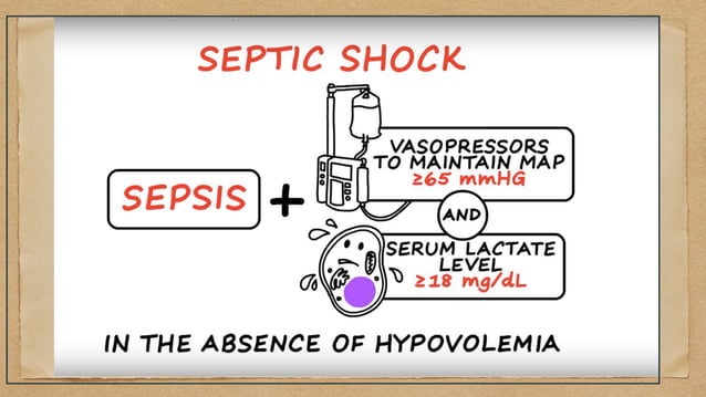 Updates on sepsis & septic shock | PPT