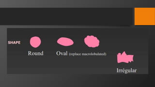 Updates and revision to the MRI BI-RADS Lexicon | PPTX