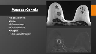 Updates and revision to the MRI BI-RADS Lexicon | PPTX