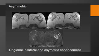 Updates and revision to the MRI BI-RADS Lexicon | PPTX