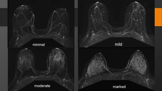 Updates and revision to the MRI BI-RADS Lexicon | PPT