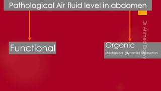 Update secrets in plain x ray abdomen gases ,air fluid level . | PPTX
