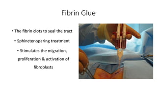 Updates in Coloproctology & colorectal surgery | PPTX