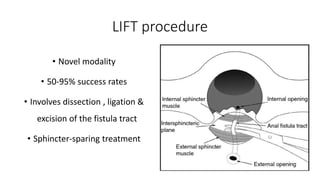 Updates in Coloproctology & colorectal surgery | PPTX