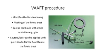 Updates in Coloproctology & colorectal surgery | PPTX