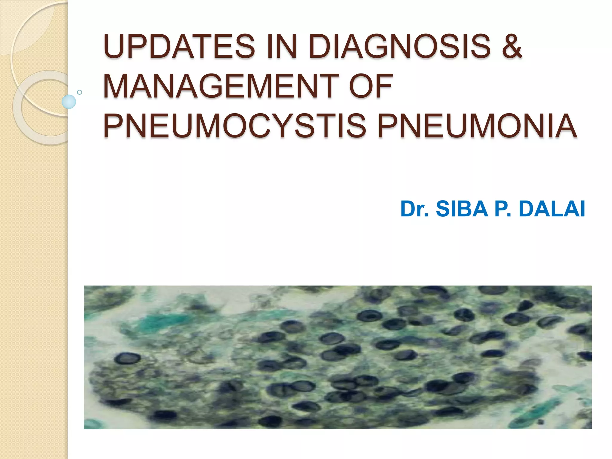 pneumocystis pneumonia | PPTX