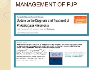 pneumocystis pneumonia | PPTX