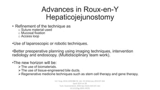updates in Hepaticojejunostomy Mohamed Alhashash. [.pptx