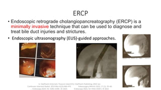 updates in Hepaticojejunostomy Mohamed Alhashash. [.pptx