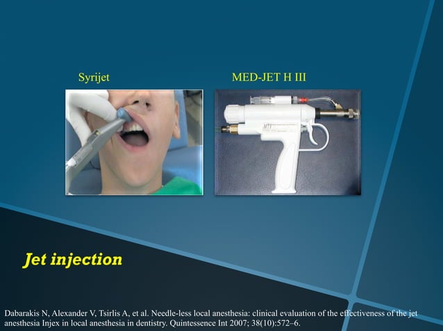 Updates in local anesthesia technique | PPT