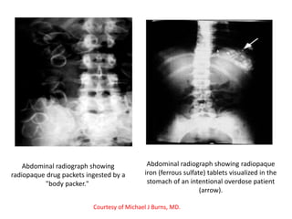 Updates in managment of acute poisoned patient | PPTX