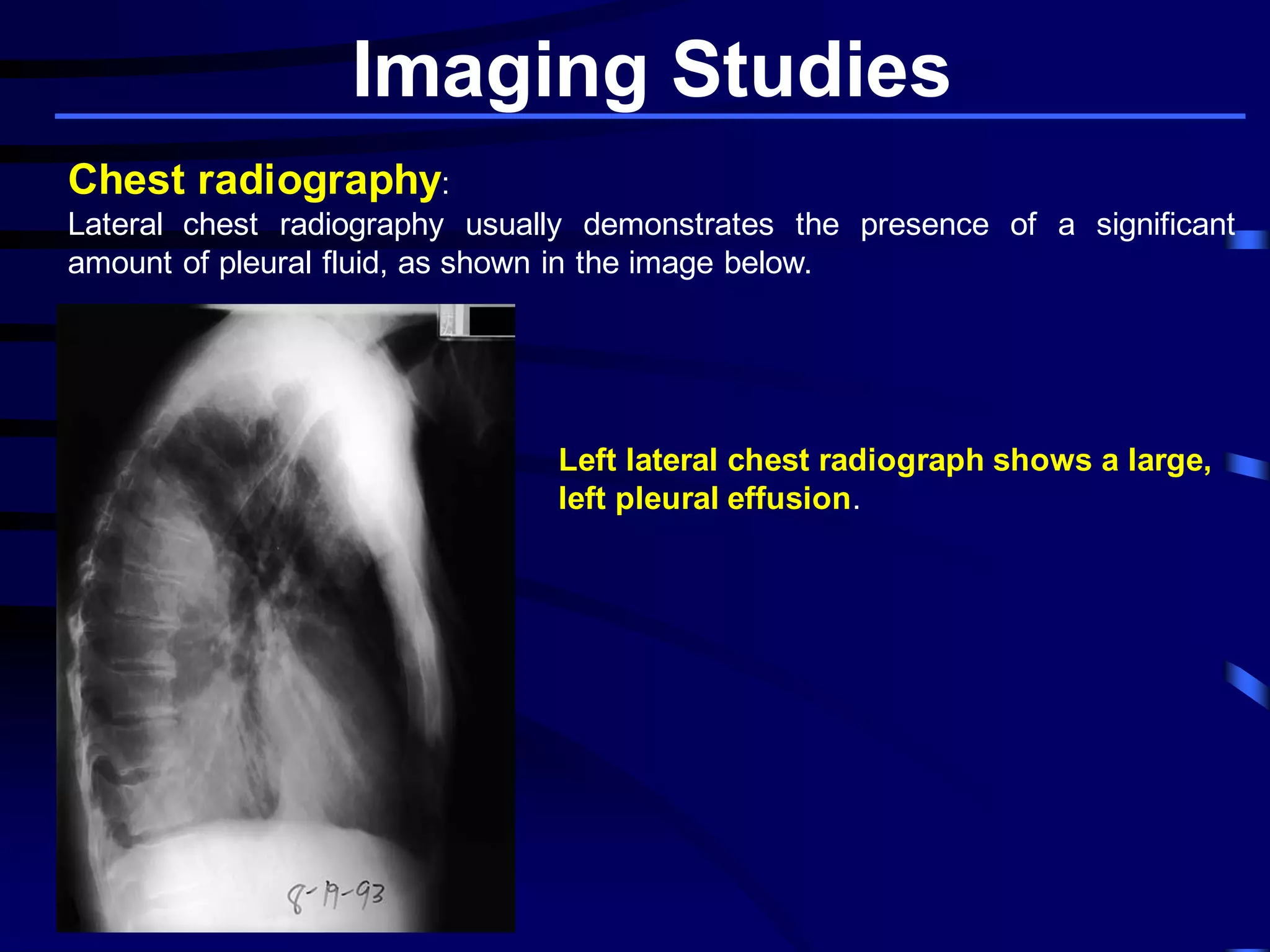 Updates in Parapneumonic Effusion and Empyema | PPT