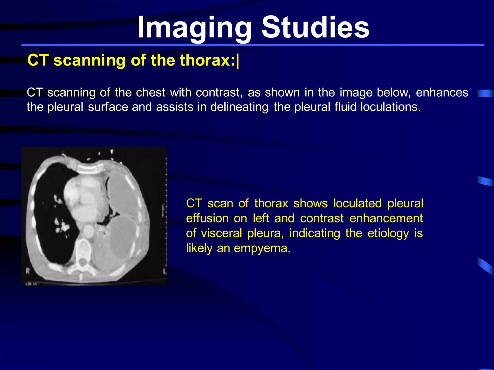 Updates in Parapneumonic Effusion and Empyema | PDF