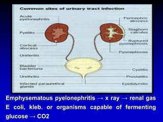 Updates of Urinary Tract Infection In Diabetic Females | PPTX