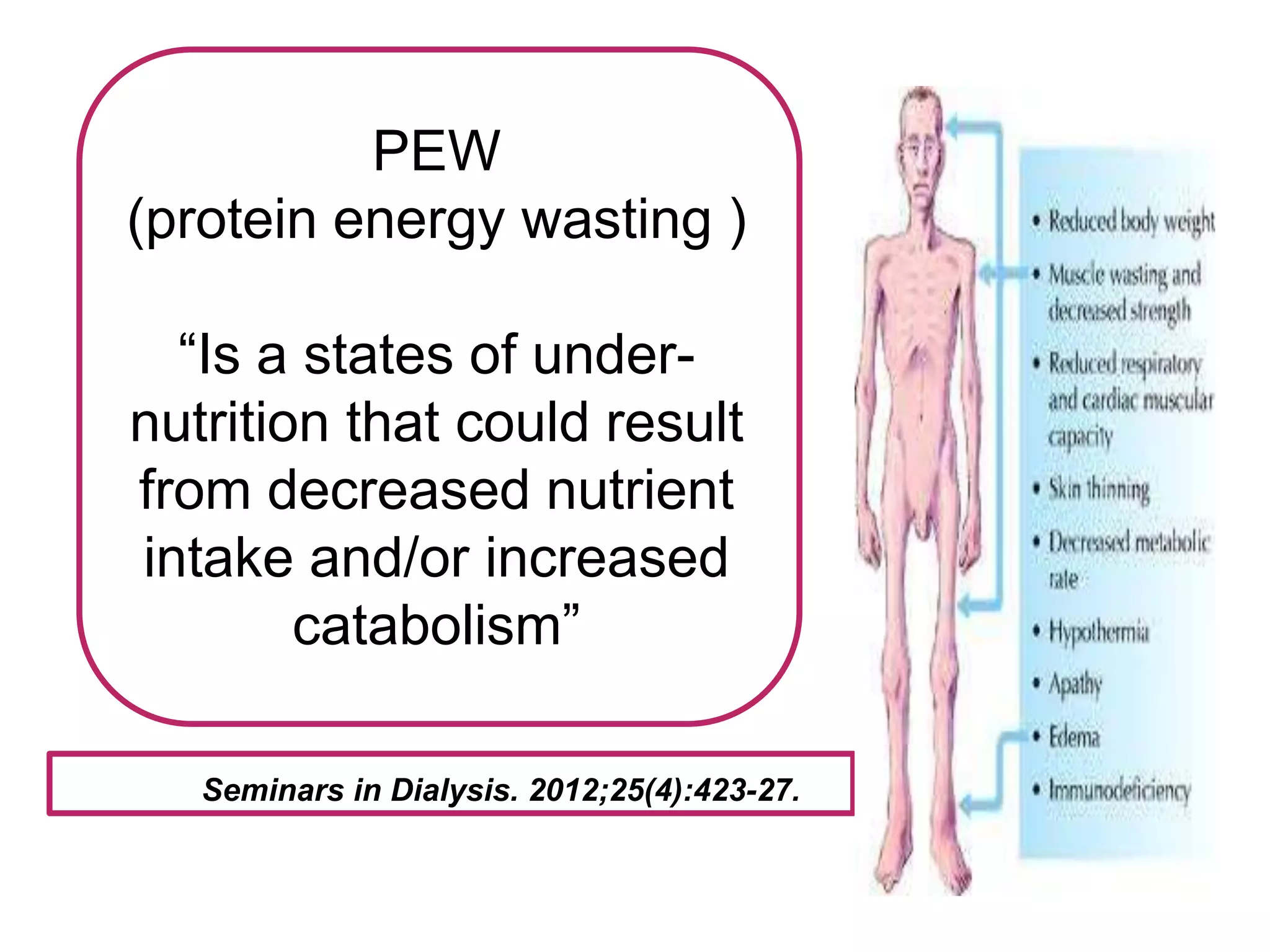 Nutrition and Hemodialysis | PPTX
