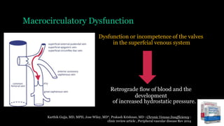 Update venous reflux | PPT