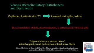 Update venous reflux | PPT