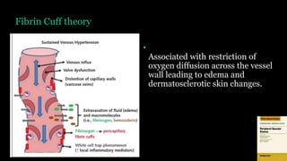 Update venous reflux | PPT