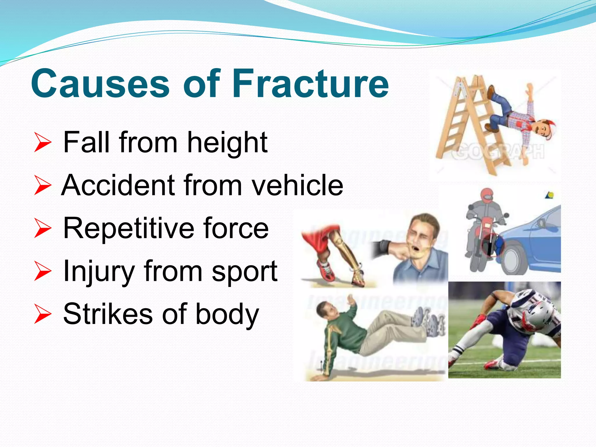 First Aid Management of Fracture | PPTX