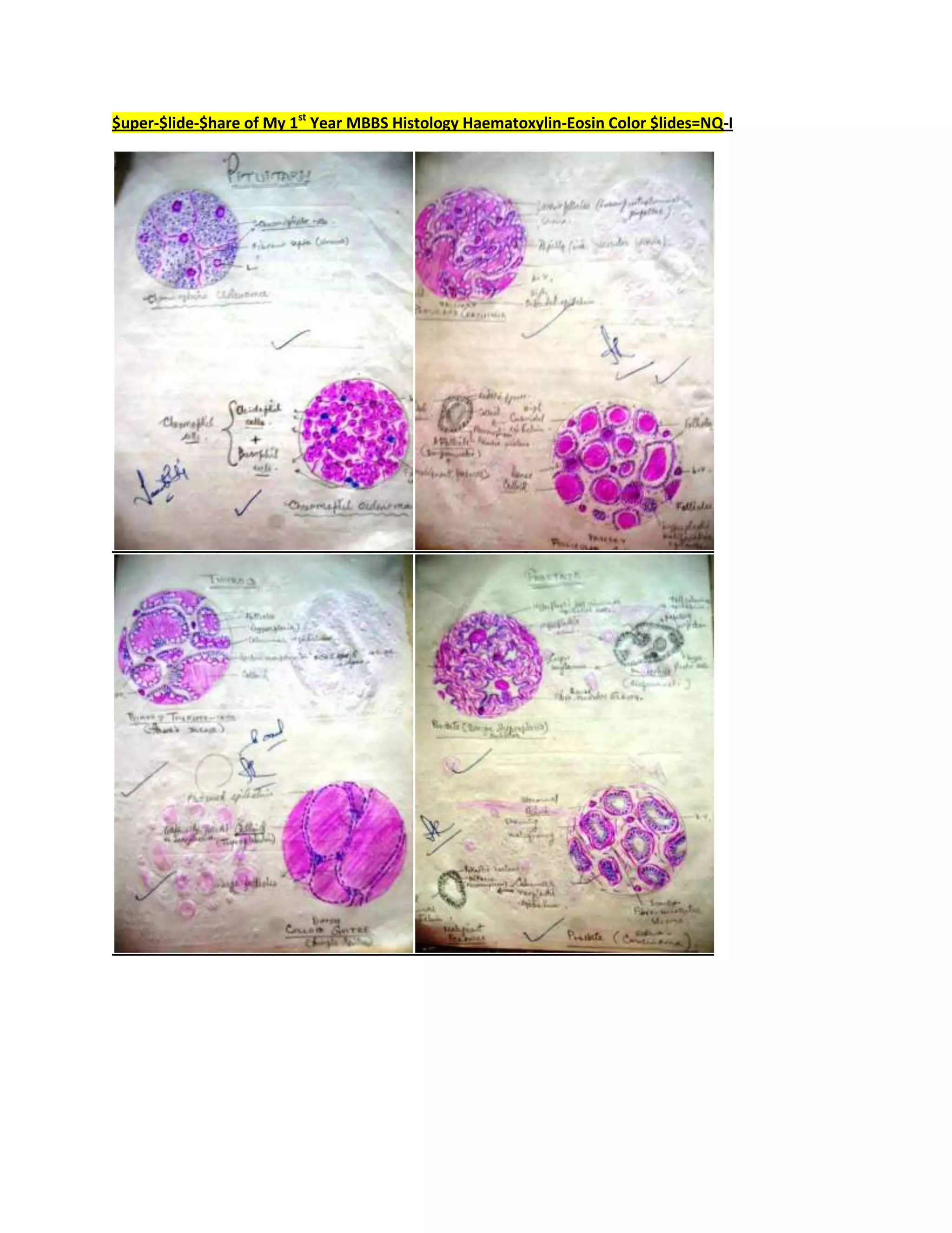$Uper $lide $hare of my 1st year mbbs histology haematoxylin--eosin ...