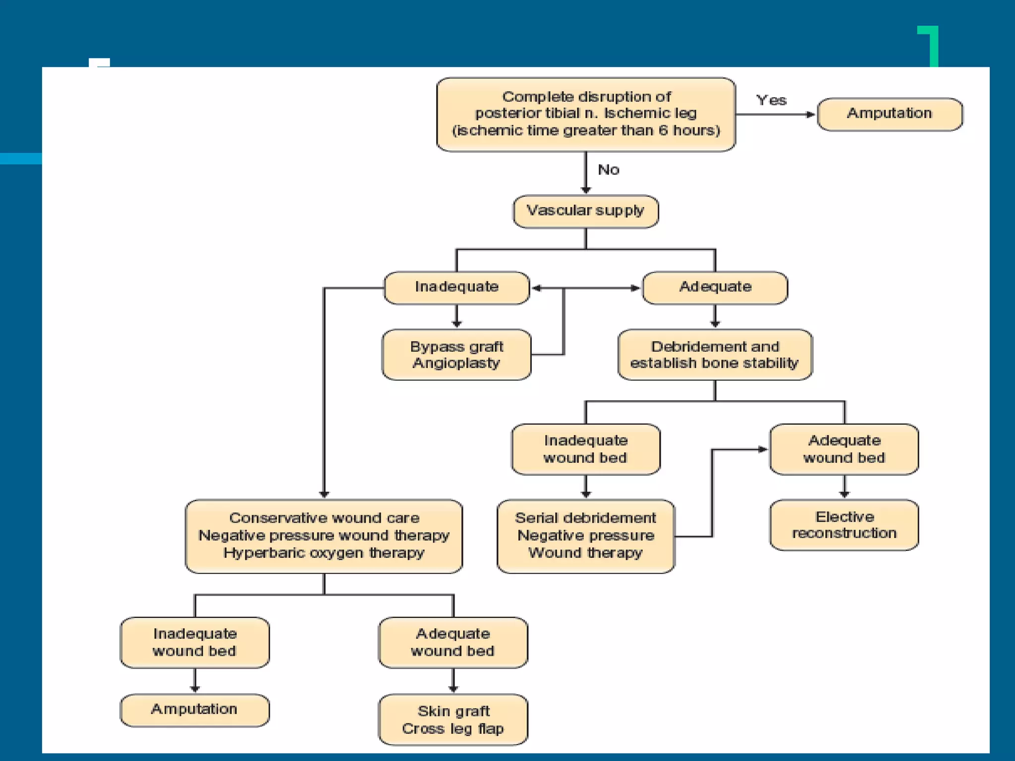 Uper n middle third leg defects | PPTX