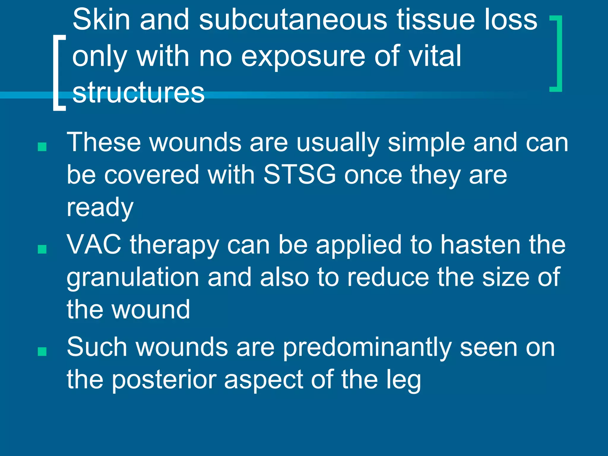 Uper n middle third leg defects | PPTX