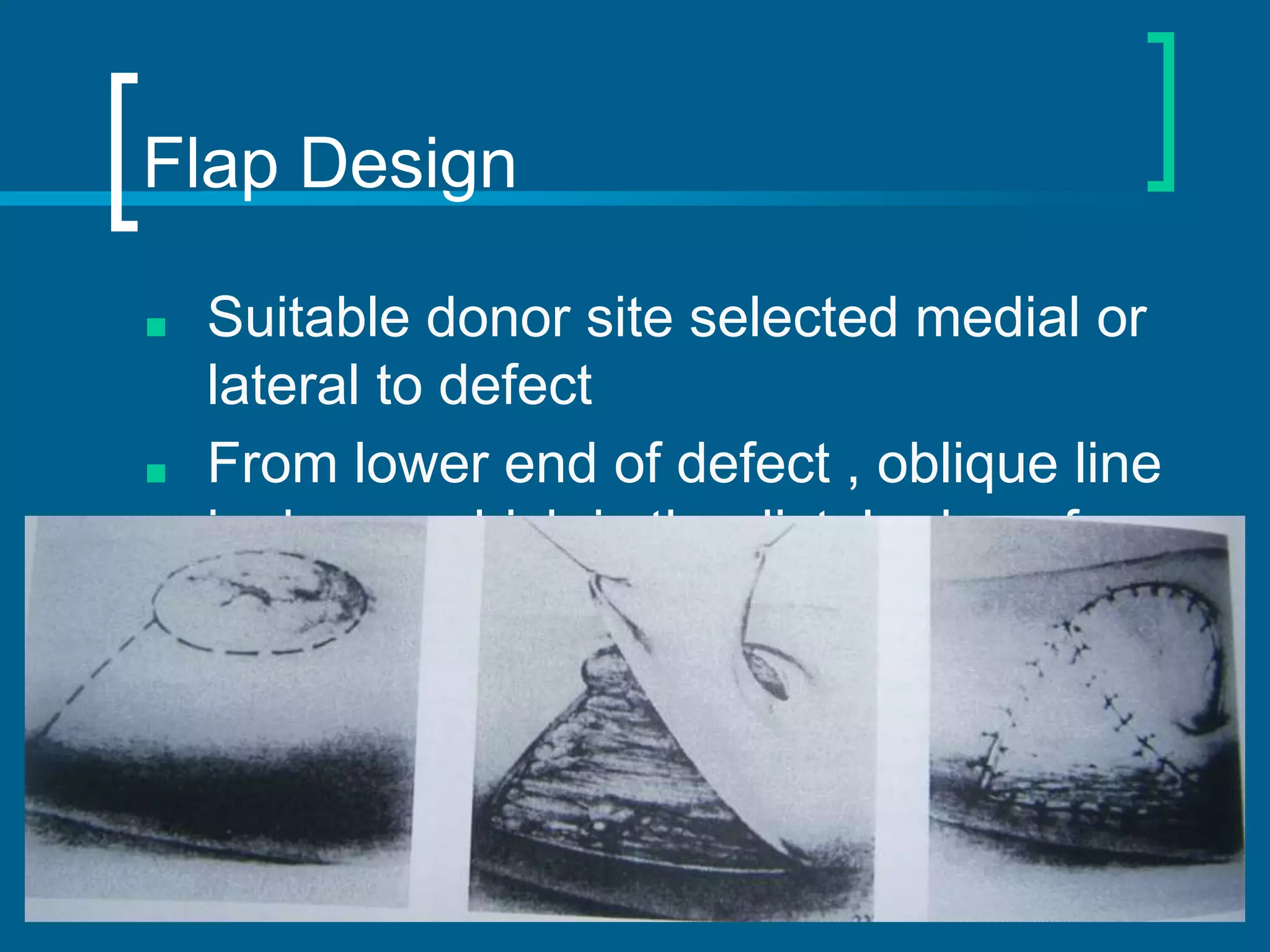 Uper n middle third leg defects | PPTX
