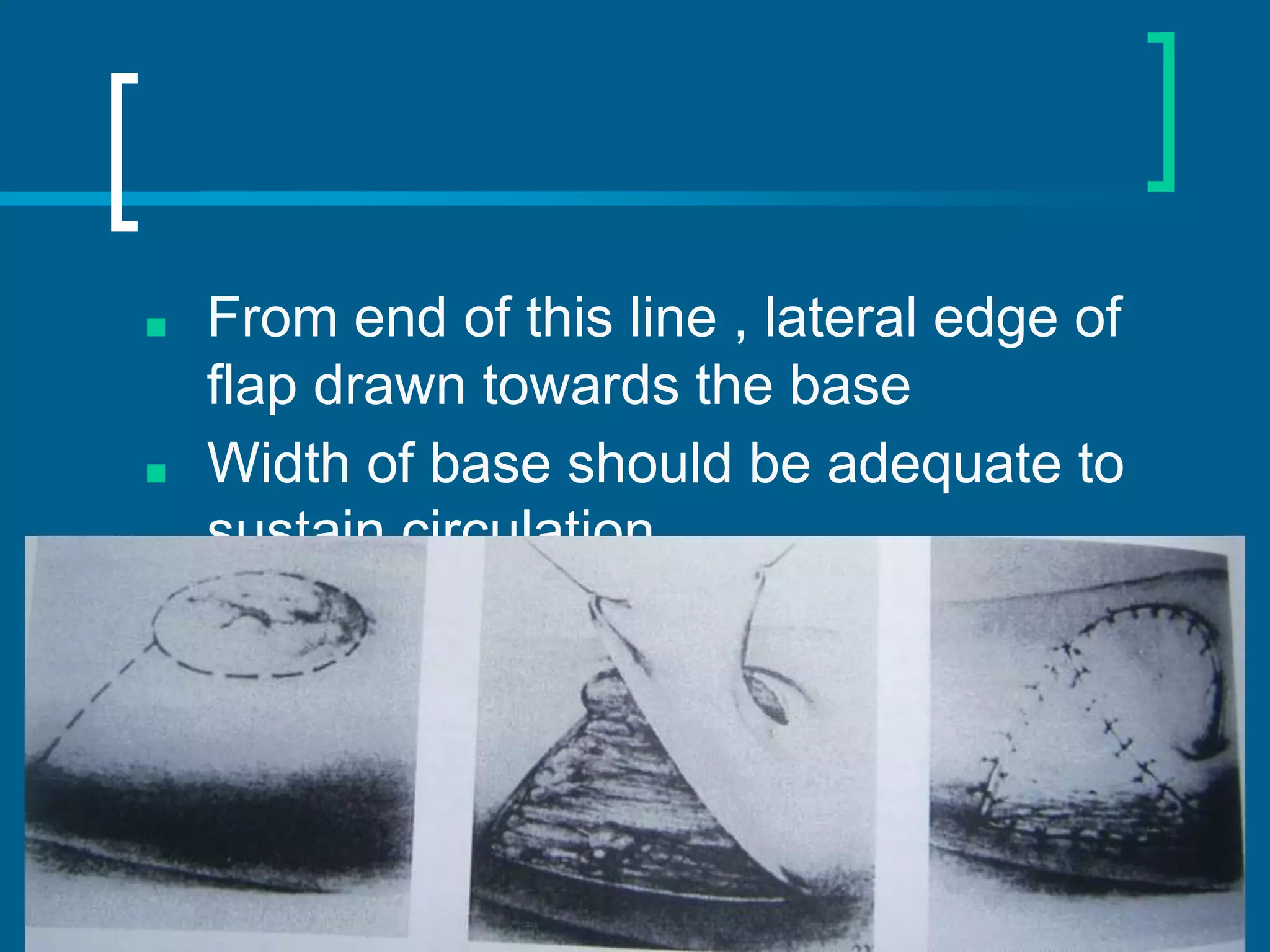 Uper n middle third leg defects | PPTX