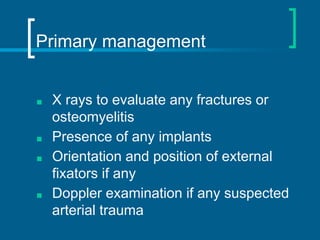 Uper n middle third leg defects | PPTX