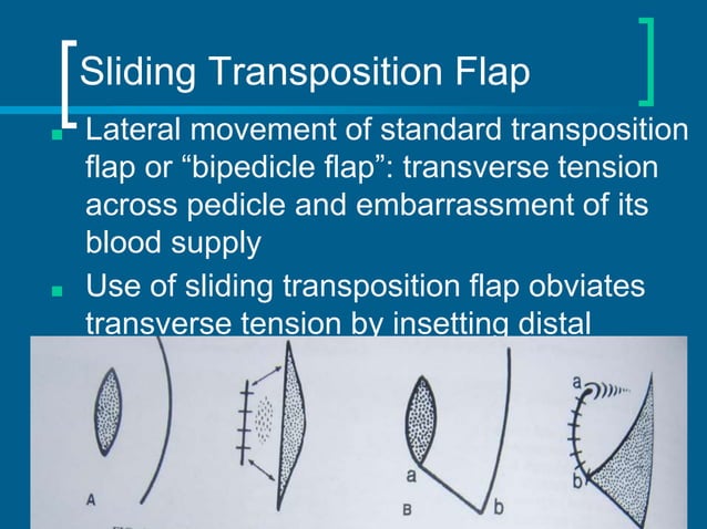 Uper n middle third leg defects | PPTX