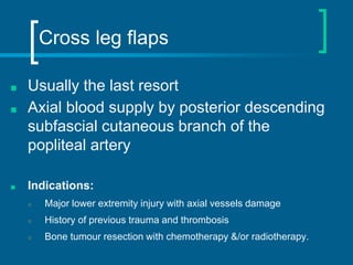 Uper n middle third leg defects | PPTX