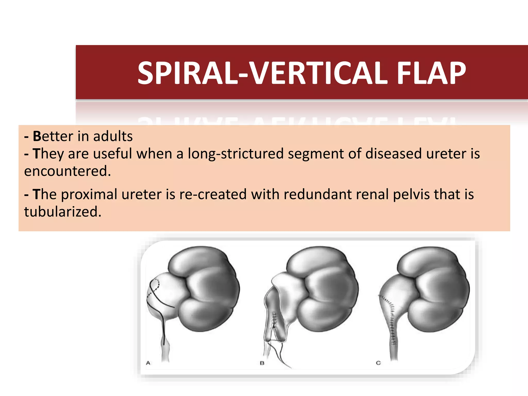 Upj obstruction | PPTX