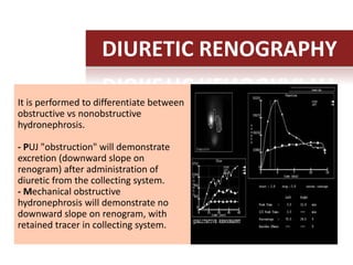 Upj obstruction | PPTX