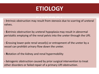 Upj obstruction | PPTX