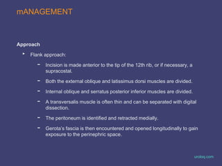 Ureteropelvic Junction (UPJ) Obstruction | PDF