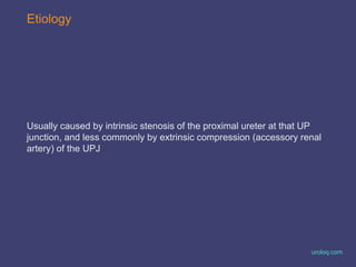 Ureteropelvic Junction (UPJ) Obstruction | PDF