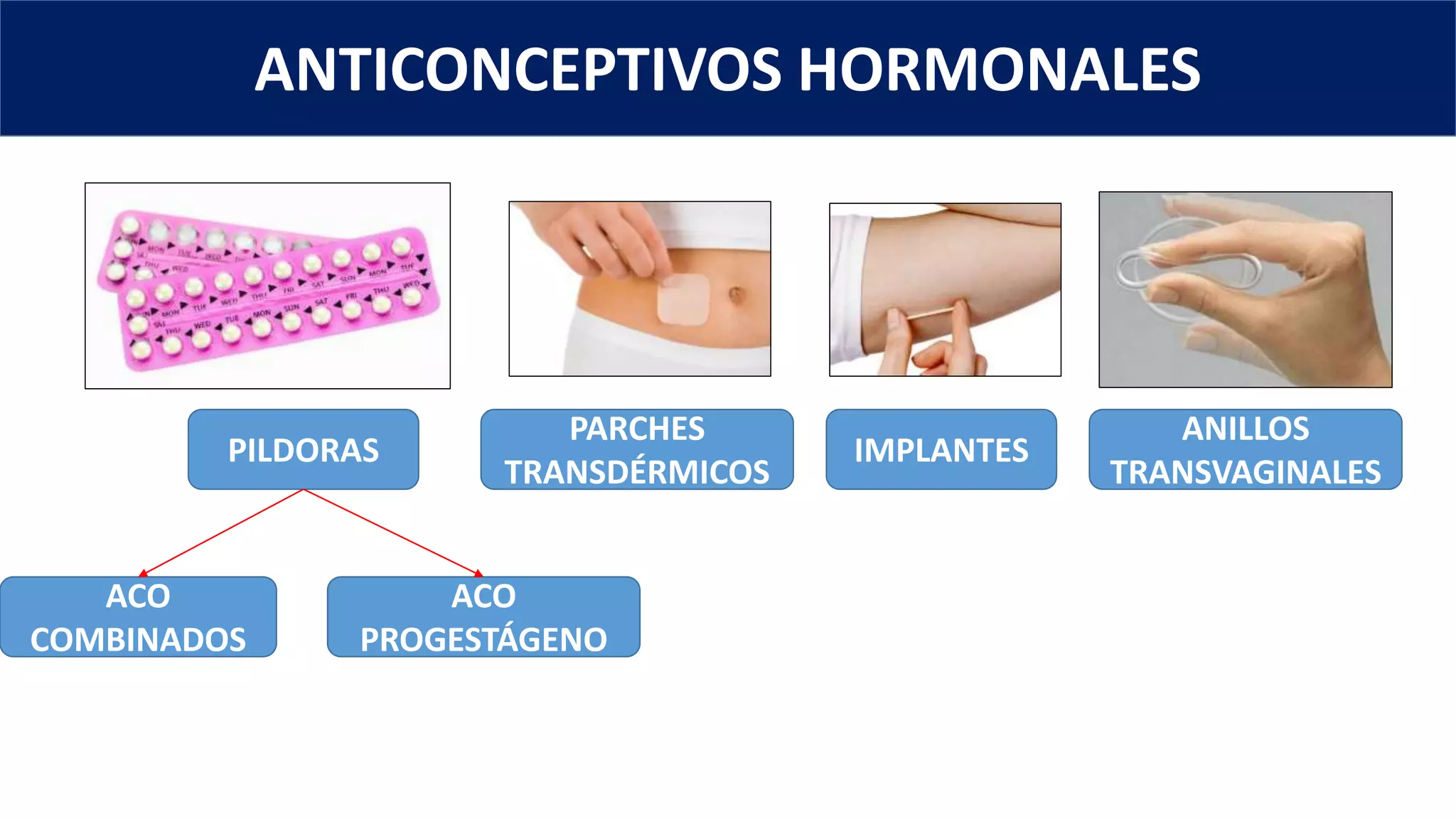 UPLA - Métodos anticonceptivos by Jean Villanueva | PPTX