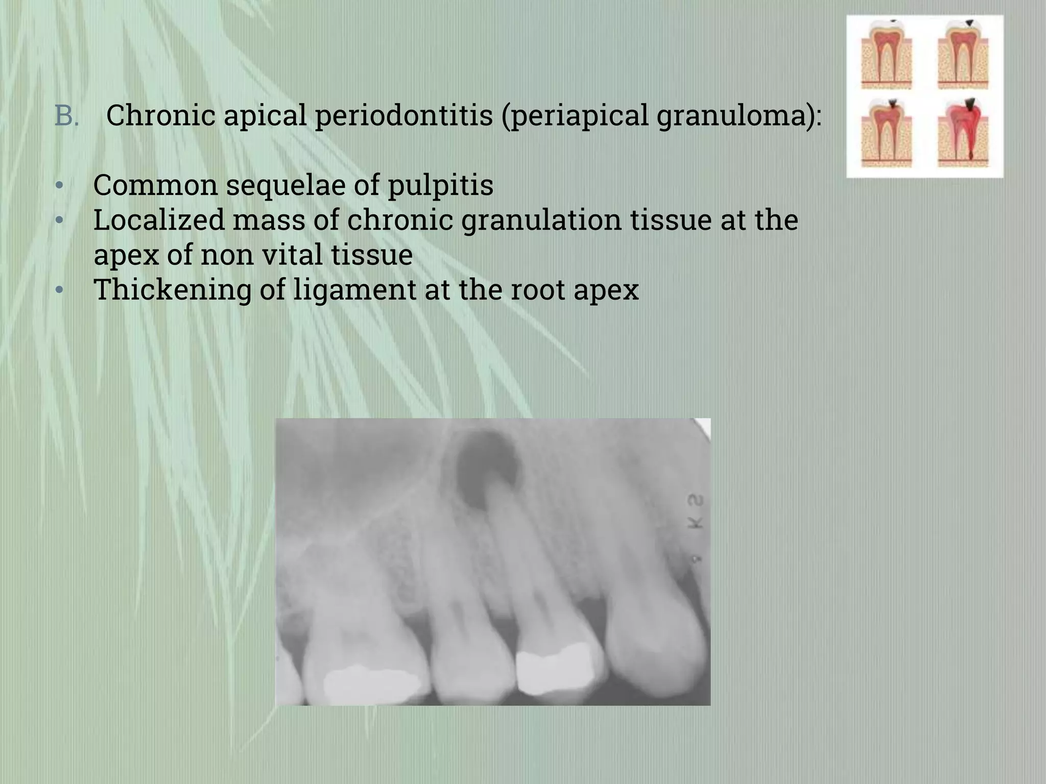 Sequelae of dental caries | PPTX