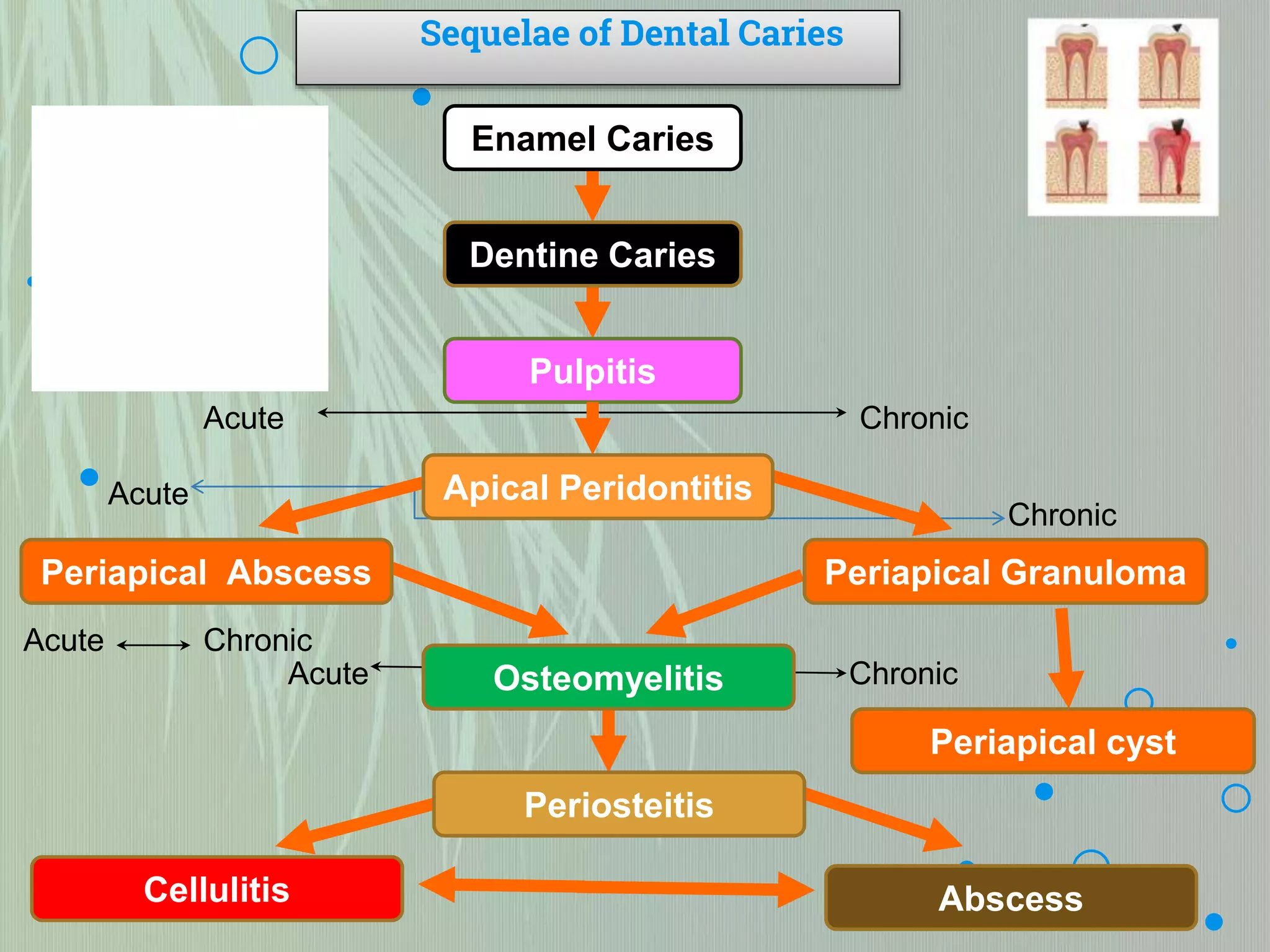 Sequelae of dental caries | PPTX