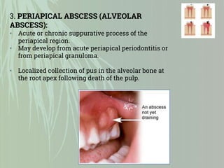 Sequelae of dental caries | PPTX