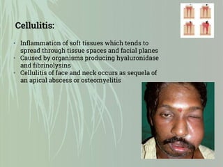 Sequelae of dental caries | PPTX