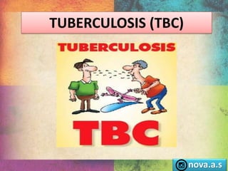 Tuberculosis | PPTX