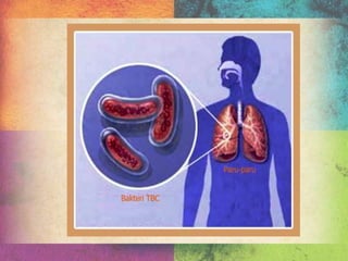 Tuberculosis | PPTX