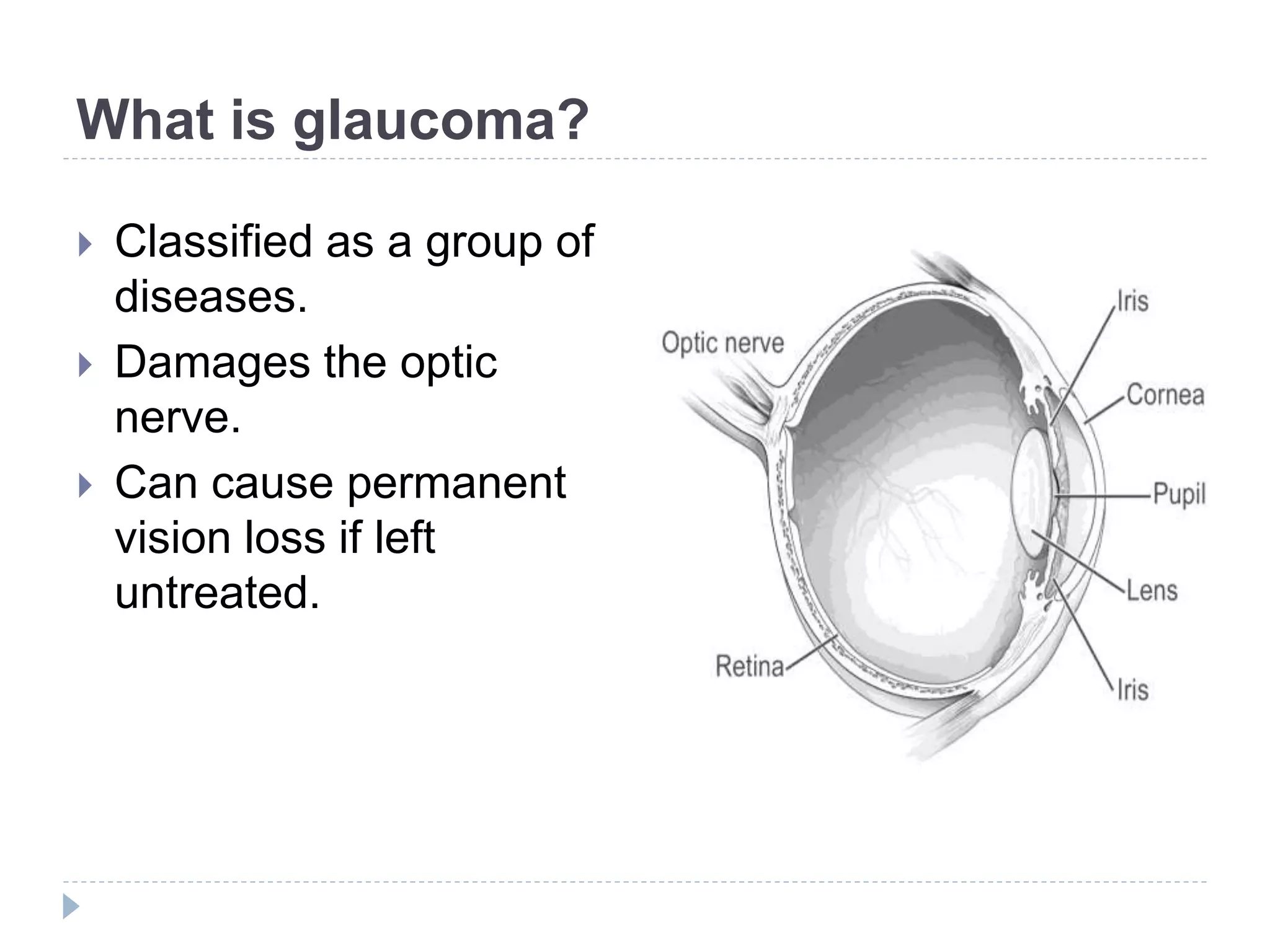 Glaucoma | PPTX