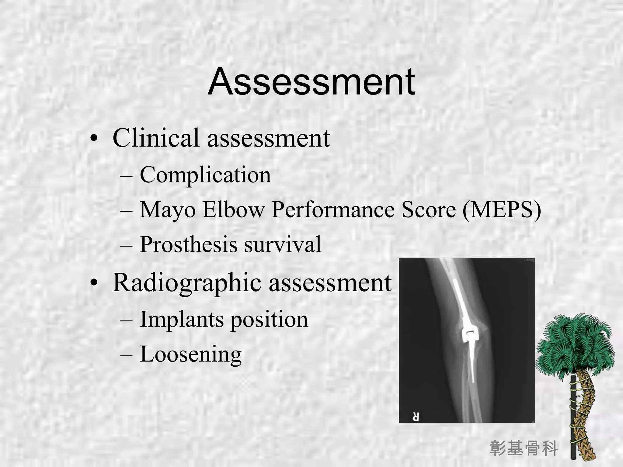Total Elbow Arthroplasty As The Salvage procedure of Nonunion or ...